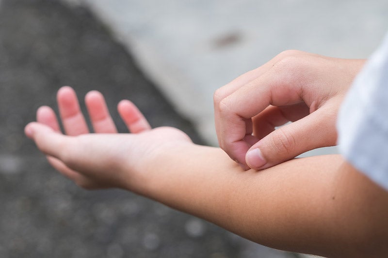 Contact Dermatitis Care Plan | K Health